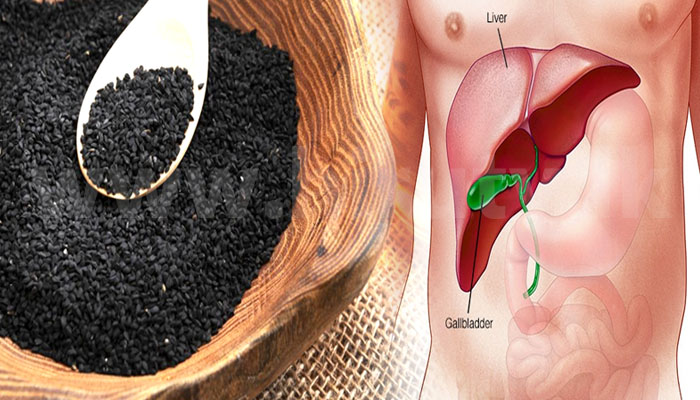දිව්‍ය ඔසුවක් වූ කළුදුරු , මෙන්න මෙහෙම භාවිතයට ගන්න|Hiru TV Blog